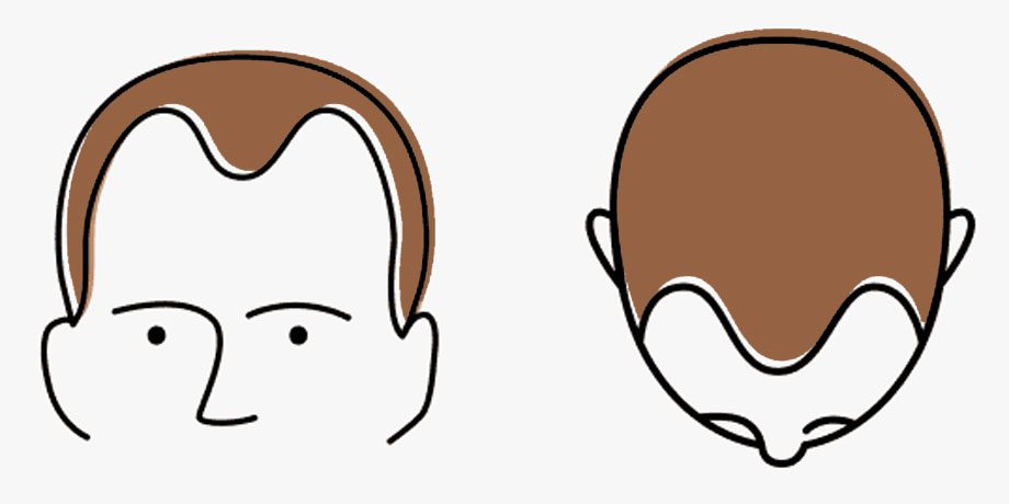 Grow more hair – Dr. J Adult's Online Healthcare